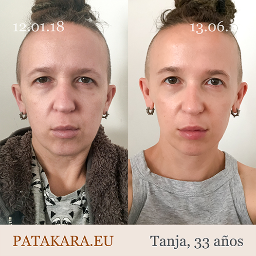 Patakara.eu | Distribuidor Oficial | Salud, Juventud y Belleza